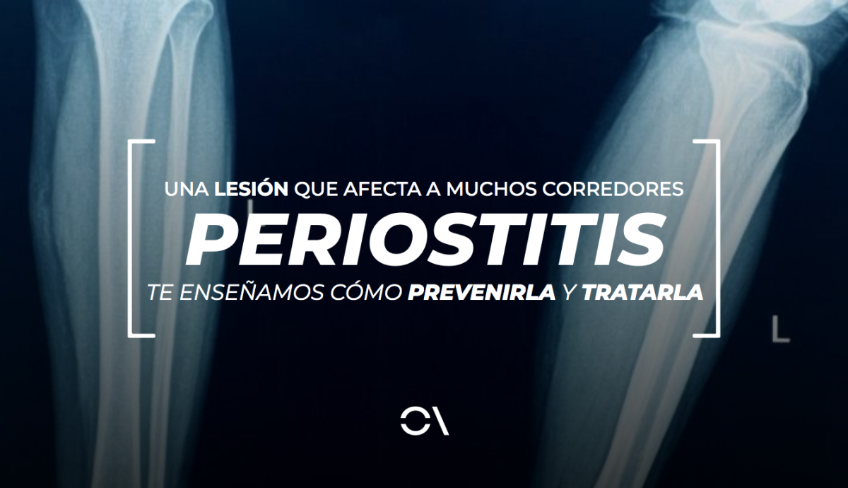 Periostitis tibial: cómo prevenirla y tratarla